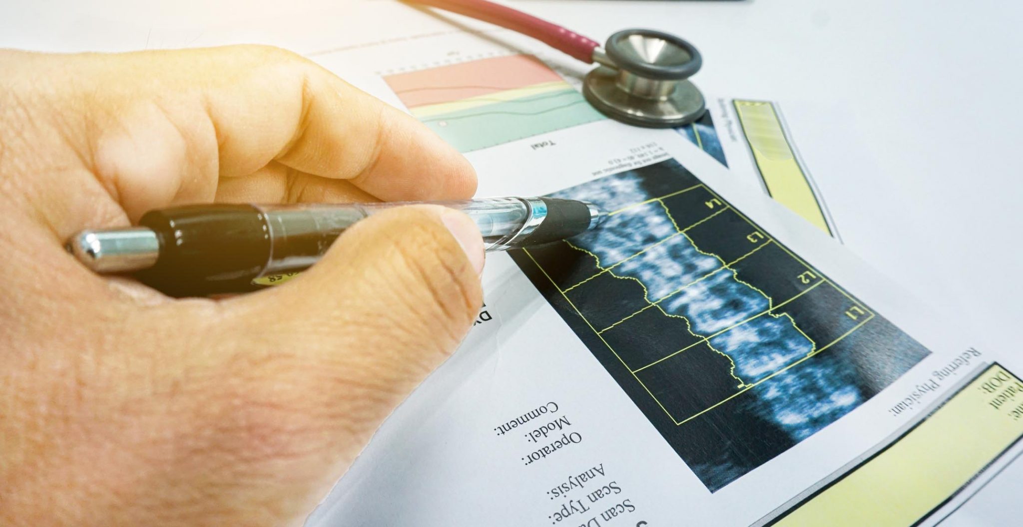 Round-up of the most topical research presented at EULAR 2020 - Medical ...