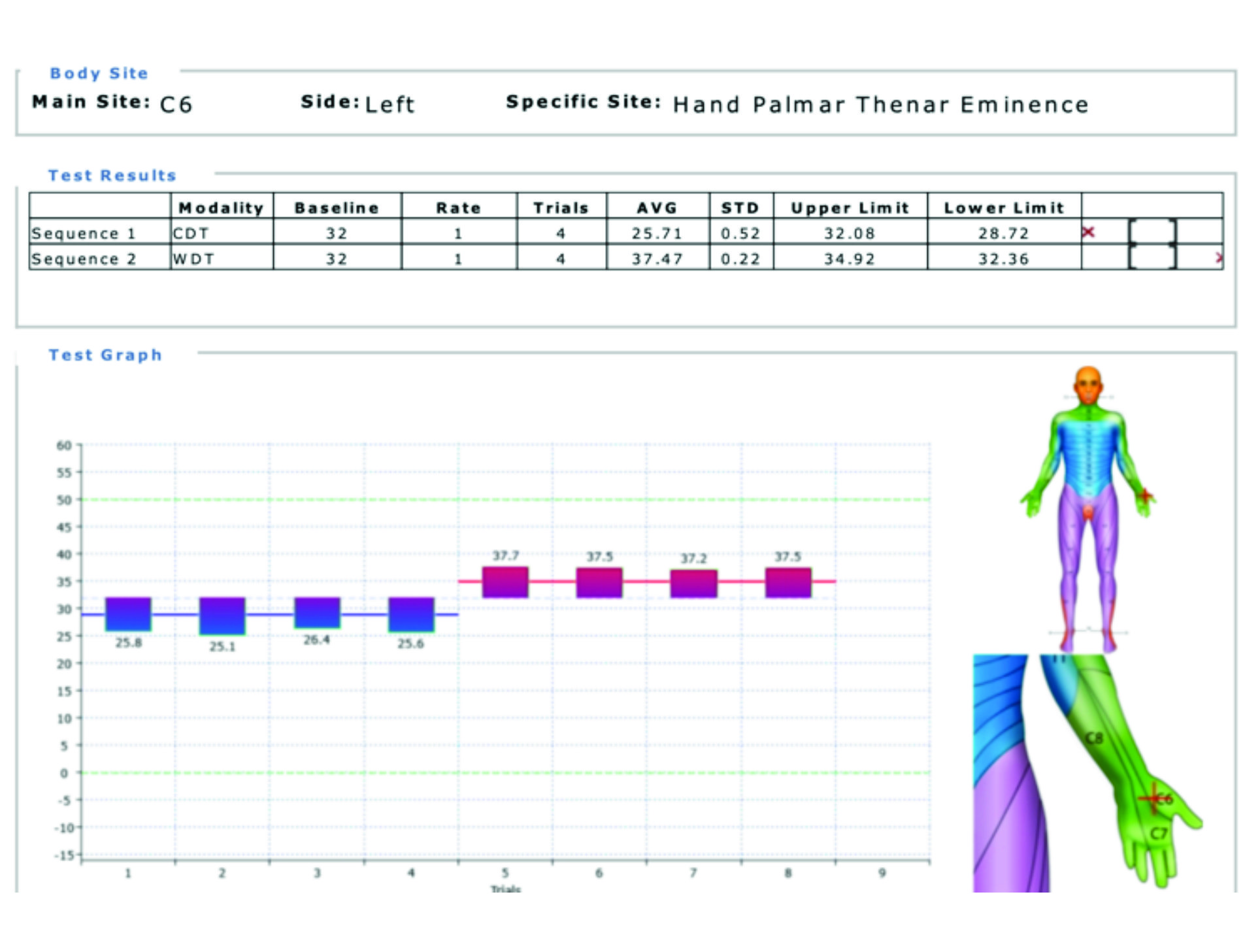 Diagnosing and managing painful small fibre neuropathy - Medical ...