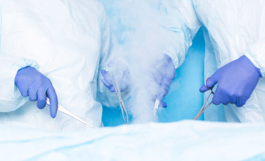 Cryosurgery, its side-effects and how to avoid them - Medical Independent