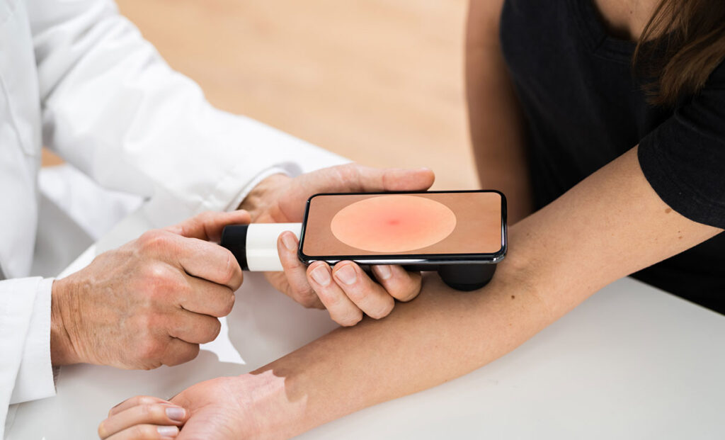 Skin cancer prevention in Ireland - Medical Independent