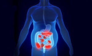 Diagnosing and managing IBD - Medical Independent