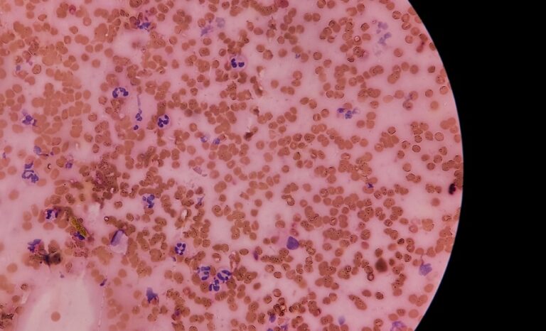 Cervical cancer – Latest treatment advances - Medical Independent