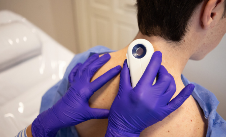 In focus: Acne - Medical Independent