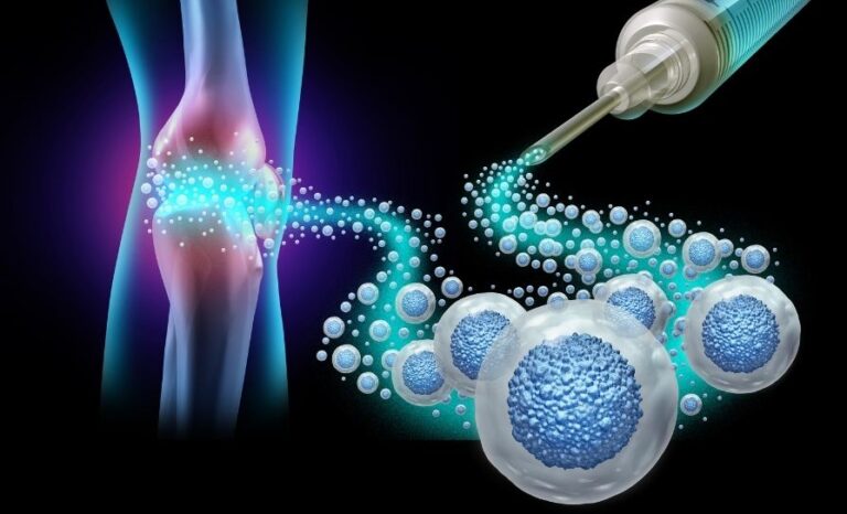 The role of regenerative medicine in musculoskeletal pain management ...