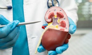 In focus: CKD mineral and bone disorder - Medical Independent