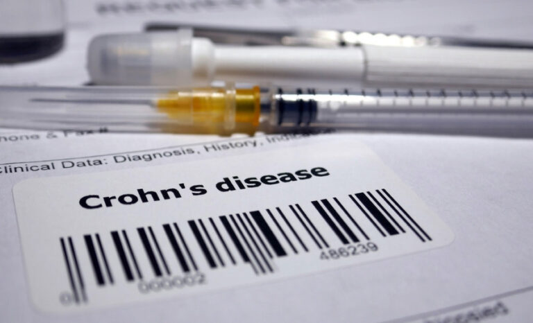Crohn’s Disease: Clinical presentation, diagnosis, treatment, and ...