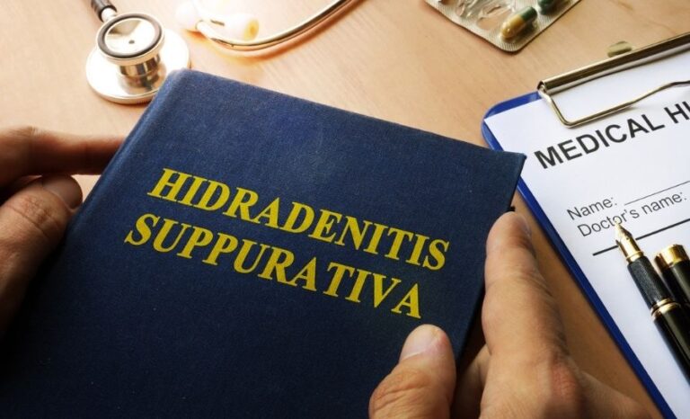A guide to hidradenitis suppurativa - Medical Independent