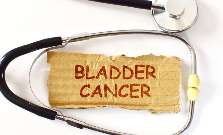 Muscle-invasive bladder cancer - Medical Independent