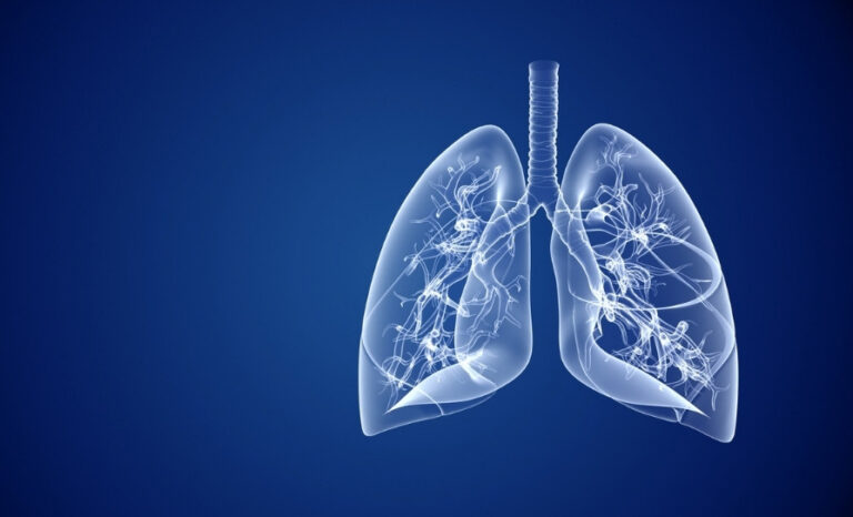 First curative surgeries performed under Lung Health Check pilot ...