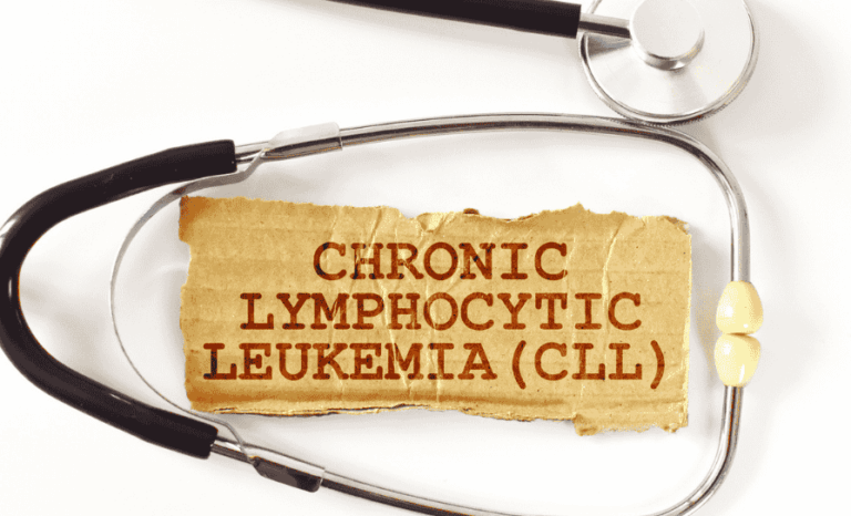 From referral to treatment and follow-up: CLL in focus - Medical ...