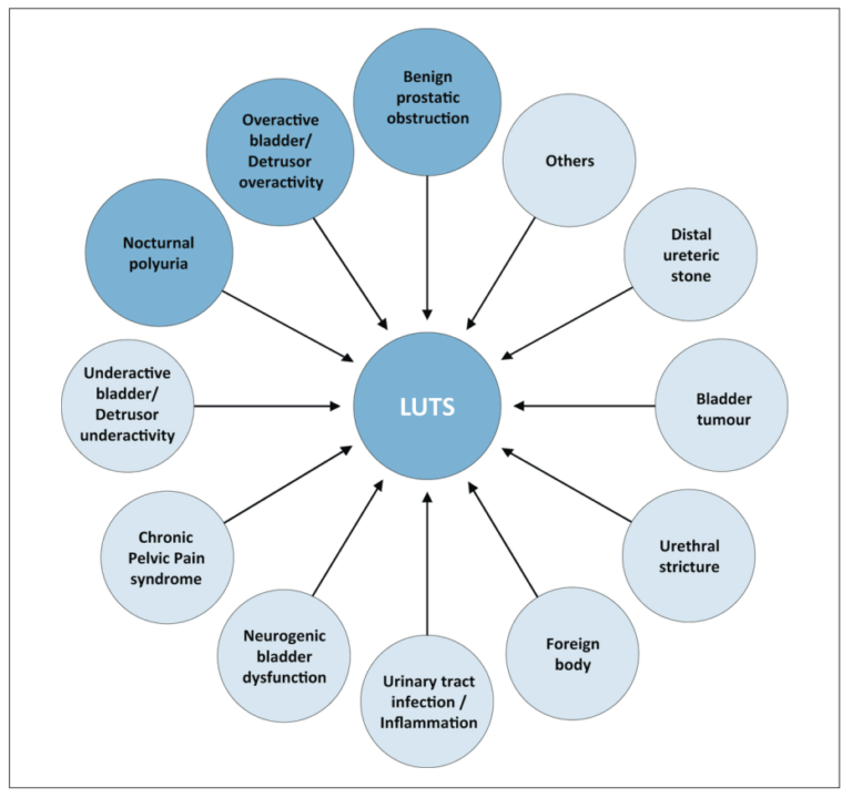Male LUTS: Assessment and management - Medical Independent